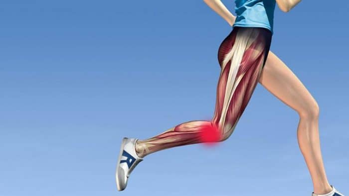 Tratamiento y prevención del síndrome de la cintilla iliotibial